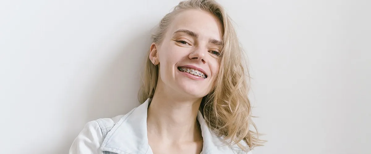 How Do I Look After My Braces? The Ultimate Guide | CURAPROX